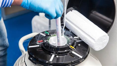Sperm Banks In The Uk 2025 Where Men Can Donate Rules And Compensation