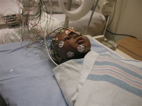 Aset Department Of Education Report Why Is Continuous Eeg In The Neonatal Intensive Care Unit