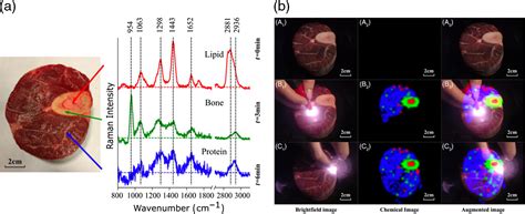 Looking For A Perfect Match Multimodal Combinations Of Raman Spectroscopy For Biomedical
