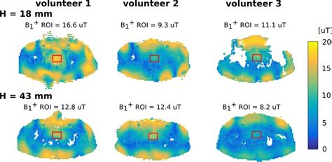 B 1 Maps Of The 8 Element Array With Different Antenna Subject Download Scientific Diagram