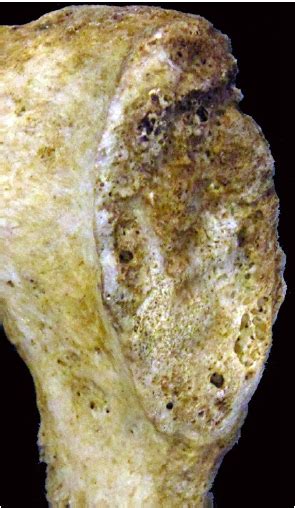 Solved Estimating Age In AdultsWe Are Going To Continue With Chegg Com