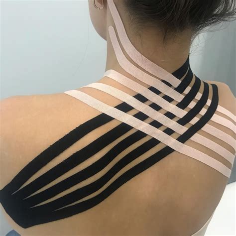 Тейпирование шеи Kinesio Taping Kinesiology Taping Kinesio Taping Shoulder