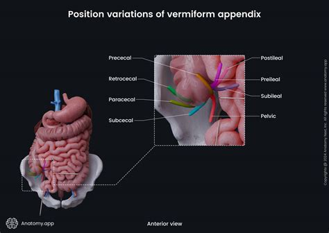 Position Variations Of Vermiform Appendix Anatomyapp