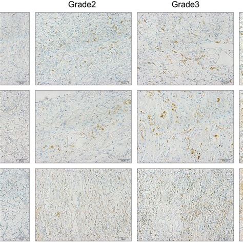 Representative Immunohistochemical Staining Of Cd8 Cd68 And Cd4 In