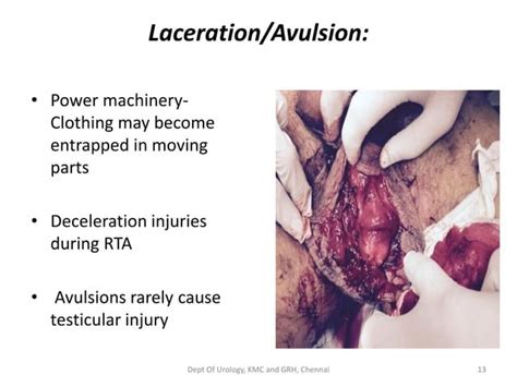 Gu Trauma External Genitalia Pdf