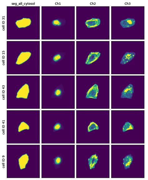 Different Segmentation Workflows — Scportrait