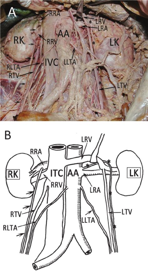 A Overview Of The Retroperitoneal Space Where The Right Upper