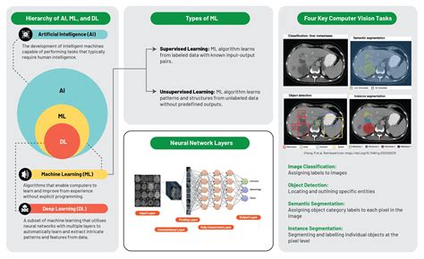 Artificial Intelligence In Radiology A New Era Of Diagnostics And Challenges