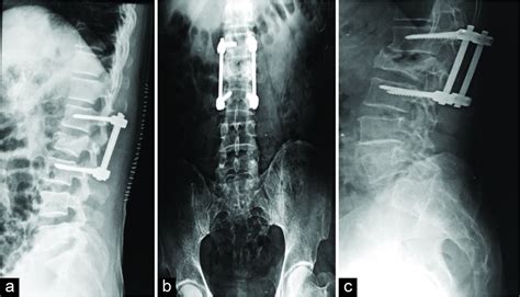 Surgical Neurology International