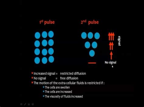 Diffusion Weighted Brain Imaging Ppt