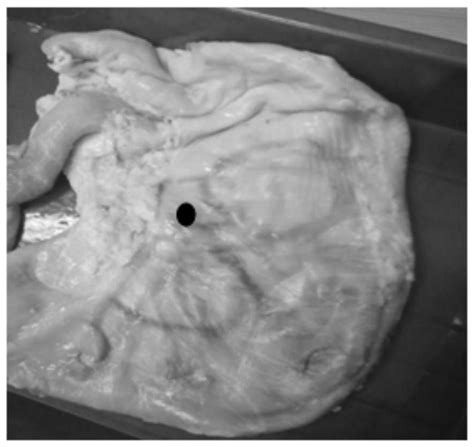 Endoscopic Thyroid Resection Training Model And Manufacturing Method Thereof Eureka Patsnap