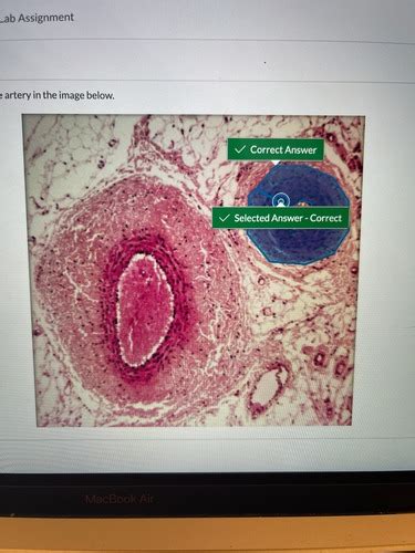 Anatomy Lab 2 Exam Flashcards Quizlet