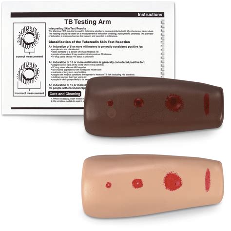 Tb Testing Arm Nasco Healthcare