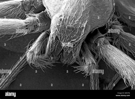 Black And White Scanning Electron Micrograph Black And White Stock