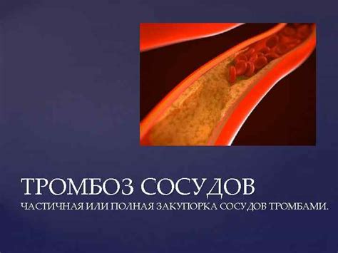 БОЛЕЗНИ СОСУДОВ АТЕРОСКЛЕРОЗ ТРОМБОЗ СОСУДИСТАЯ НЕДОСТАТОЧНОСТЬ КОЛАПС