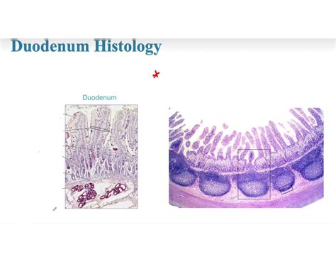Duodenum Histology Quiz