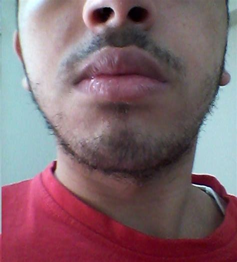 Patchy Beard Success Stories Before And After Photos Page Beard Board