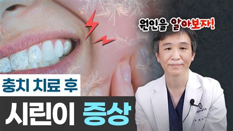 충치 치료를 받았는데 치아가 시리다 충치 치료 후 치아 시림 현상 알려드립니다 Youtube
