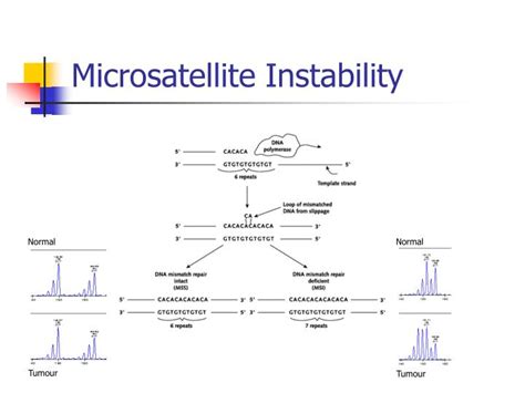Ppt Microsatellite Instability In Sporadic Colorectal Cancer A