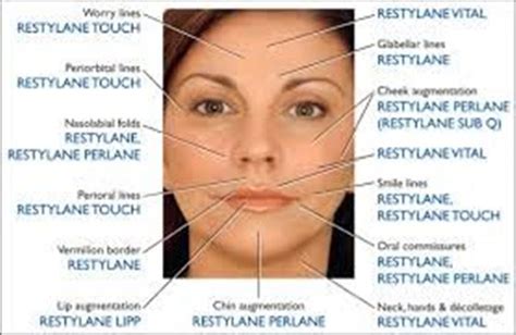 Botox Injection Face Diagram