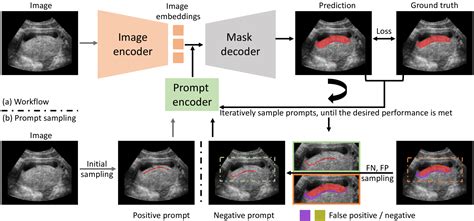 Interactive Segmentation Model For Placenta Segmentation From 3d