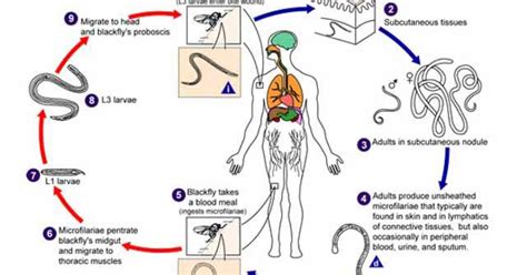 Onchocerciasis Life Cycle Image