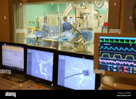 Cerebral Aneurysm Embolization Willis Polygone Angiography Interventional Neuroradiology
