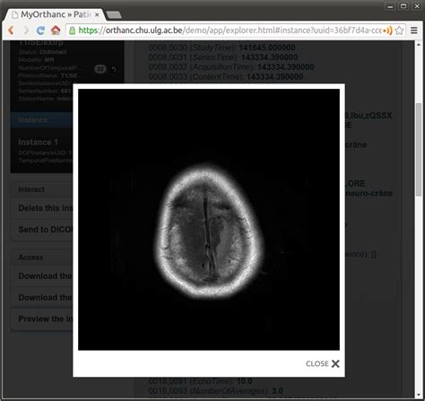 通过orthanc了解dicom Alexiusll 的博客