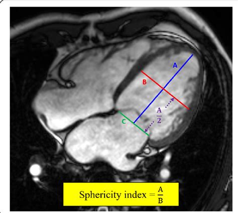 Calculation Of Sphericity Index Download Scientific Diagram