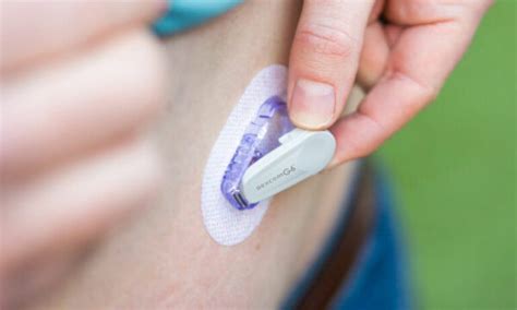 Dexcom Vs Medtronic Which Is The Best CGM For You