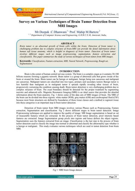 hybrid model for detection of brain tumor using convolution neural