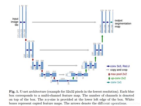 [cv 图像分割]生物医学图像语义分割 Swin Unet模型 知乎