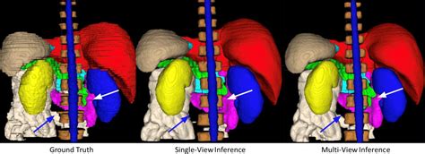 Figure 3 From Fully Automated Multi Organ Segmentation In Abdominal Magnetic Resonance Imaging