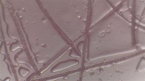 picroscope a digital raspberry pi based microscope that you can build