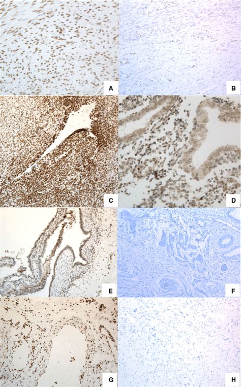 Formalin PFA Fixed Paraffin Embedded Sections Stained For 8 Hydroxy 2 Download Scientific