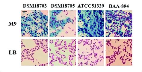 Light Microscopic Observation Of Four Cronobacter Species Grown On Download Scientific