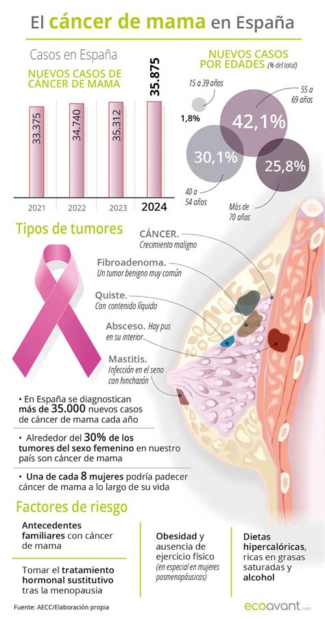 Situación Del Cáncer De Mama En España En Gráficos Y Datos