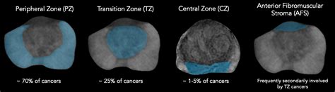 Prostate Gland Anatomy Mri