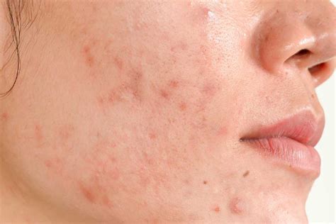 பர வநத தழமப மறய வககனம இத சல எளய வழகள உஙகளககக லஙகசற நயஸ