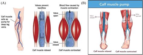 Is It Important To Hit Calves On Leg Day — Treadwell Dpt