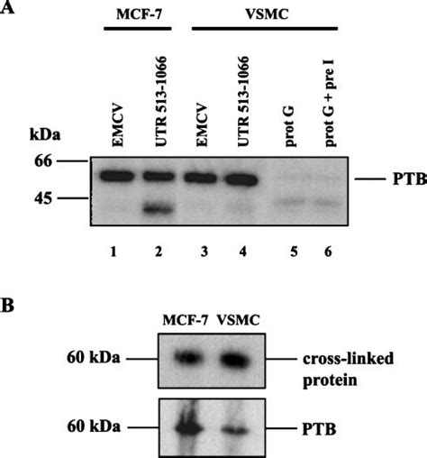 Immunoprecipitation And Western Blot Analysis Of The Uv Cross Linked