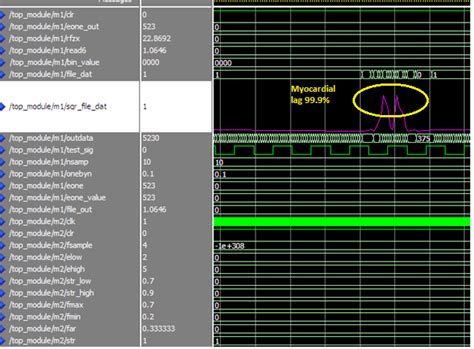 Vlsi Projects In Chennai Contact 8939504005 Myocardial Function