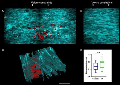 Collagen Organization And Microcalcification Clusters At Day 21 A Download Scientific