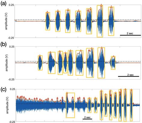 Examples Of The Detected Note Algorithm A Detected Notes Yellow Download Scientific Diagram