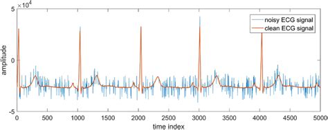 Clean Ecg Signal And A Noisy Ecg Signal With An Additive White Gaussian Download Scientific