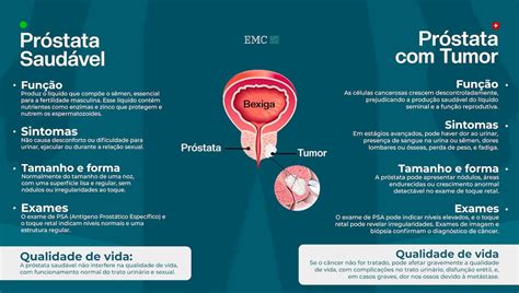 Estagios Do Cancer De Prostata 432x510