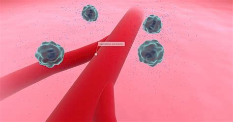 Premium Photo Anaphylaxis Histamine Release And Vascular Edema