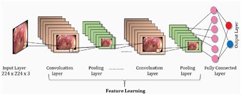 Figure 1 From Automated System For Colon Cancer Detection And