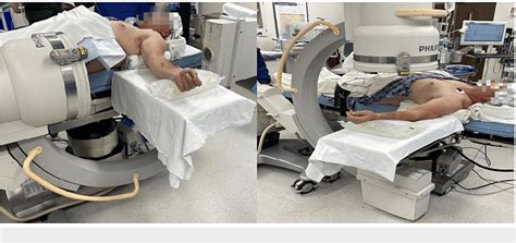 Figure 1 From A Novel Positioning Technique For Olecranon Fracture Fixation Semantic Scholar