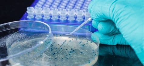 How To Select An E Coli Strain Eppendorf 艾本德